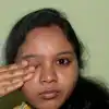 What Is Eye Worms,കണ്ണില്‍ വിര വരുമോ? കാരണം എന്താണ്? - what causes eye ...