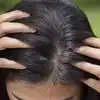 Grey Hair Remedyമുടി കറുപ്പിക്കാൻ ഇതിലും എളുപ്പ വഴി വേറെയില്ല വെറും 4206