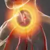 Food Pipe Cancer Symptoms and Treatment Remedies for Esophageal Cancer ...