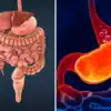 Include These 10 Foods In Diet For Clean Colon Gut Intestine And Get ...