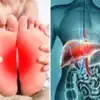 These 5 Symptoms Shows In The Feet And Legs Indicates Liver Failure ...
