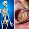 Vitamin D is Most Important Than Calcium For Beat Osteoporosis, Weak ...