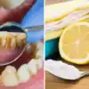 Effective Home Remedies For Remove Yellow Tartar Plaque From Teeth And ...