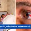 Zika Virus vs Dengue Virus Symptoms, Zika Virus Pune, Home Remedies For ...