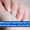 Calcium Deficiency Symptoms, Signs On Nails; Home Remedies, Diet, Foods ...