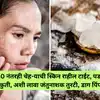 How To Apply Alum On Skin Or Face For Wrinkles, Pimples, Acne, Dark ...