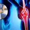 Home Remedies For Knee Pain And Increase Greece In Joints; गुडघेदुखी ...