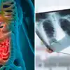 MEDSRX Formula For Avoid Cancer Risk; कॅन्सर होऊ नये म्हणून MEDSRX ...