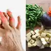 Vegetables for reducing uric acid and arthritis Joint Pain; युरिक ॲसिड ...