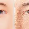 How to apply mustard oil on face; चेह-यावर मोहरीचं तेल कसं लावावं ...