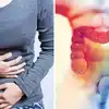 Home remedies and doctor joseph tricks to relax poop at home before ...