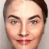 Why Face Darkens Suddenly, Melanin, Hormones & Liver Health causes to ...