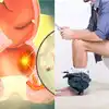 Home Remedies For Piles And Constipation,Causes of Piles : तुम्हीही ...