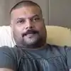 Daya Hair Transplant Treatment,CID फेम दयाने केलं हेअर ट्रान्सप्लान्ट ...