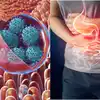 3 Home Remedies to Cure Stomach Infection or Gastroenteritis; पोटात हे ...