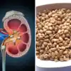 How To Get Rid Of Kidney Stones,बड़ी से बड़ी Kidney Stone को गला सकते ...