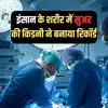 pig kidney transplant to human: सूअर की किडनी ने दान किए गए मानव शरीर ...