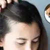 Benefits Of Alum For Hair,एक ही बार में दिखेगा असर, फिटकरी से धुले ...