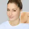 What Makes Indian Skin Tone Darker,गोरा करने वाली सारी क्रीम हैं बकवास ...