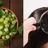 Permanent Solution For Dandruff At Home,गर्मियों में रूसी ने कर दिया है ...