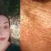 How To Make Your Skin Glow Naturally At Home,1 चीज है झाइयों-कालेपन की ...