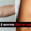 Causes Of Lump In Arm And Legs,हाथ-पैर में बन गई है छोटी छोटी गांठ, मगर ...