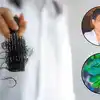 Home Remedies For Hair Growth And Thickness,'गंजे सिर में दुधी का रस ...