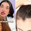 How To Increase Hair Growth,चोटी करते-करते भी उड़ गए बाल? शैंपू नहीं ...