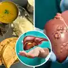 How To Cure Fatty Liver,How to Reduce Fatty Liver: प्लेट में रखें 3 ...