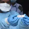 Coronavirus Ke Lakshan|Corona New Symptoms: Backache, Nausea & Rashes ...