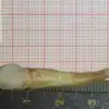Dentist Pulls Worlds Longest Known Human Tooth Received A Certificate ...