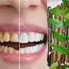 Teeth whitening: पीले दांतों को सफेद बनाने के 5 सस्ते आयुर्वेदिक तरीके ...