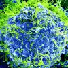 Siberia Permafrost Virus: Scientists Revived Ancient Zombie Viruses ...