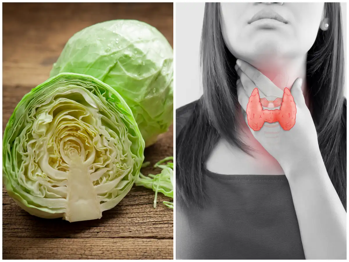 Thyroid Disease And Cabbage,തൈറോയ്ഡ് ഉള്ളവര്‍ കാബേജ് കഴിച്ചാല്‍ പ്രശ് ...