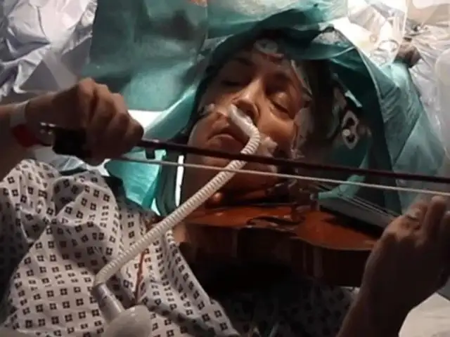 Woman Play Violin During Brain Surgery,ब्रेन ट्युमरच्या सर्जरीवेळी 'ती ...