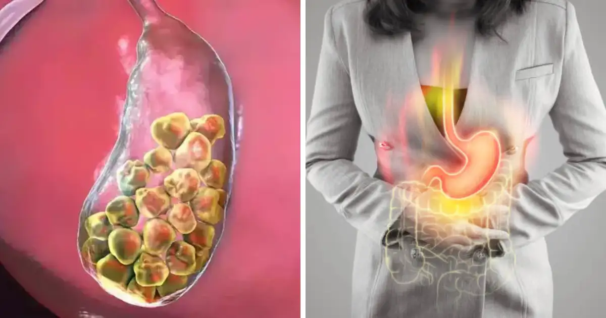 Natural Remedies For Acid Reflux Gas : अर्ध्या रात्री पित्त किंवा ...