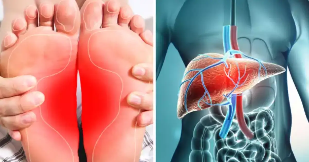 These 5 Symptoms Shows In The Feet And Legs Indicates Liver Failure ...
