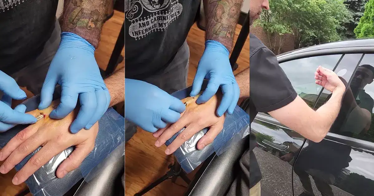 Tesla Car Owner Implants Chip in His Hand to Unlock Car; Marathi News ...