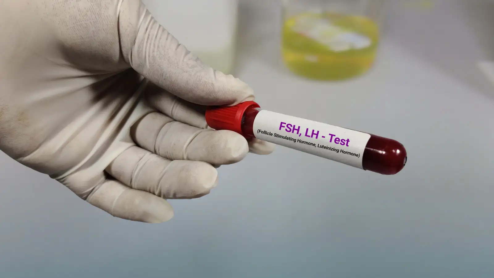 FSH and Fertility: What Hormone Levels Mean for Women