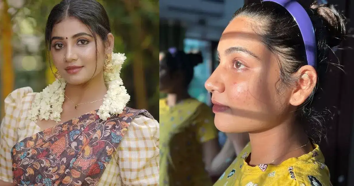 Anshitha Photo,മേക്കപ്പ് ഇട്ടില്ല എങ്കിലും ഞാന്‍ സുന്ദരിയാണ് എന്ന് ...