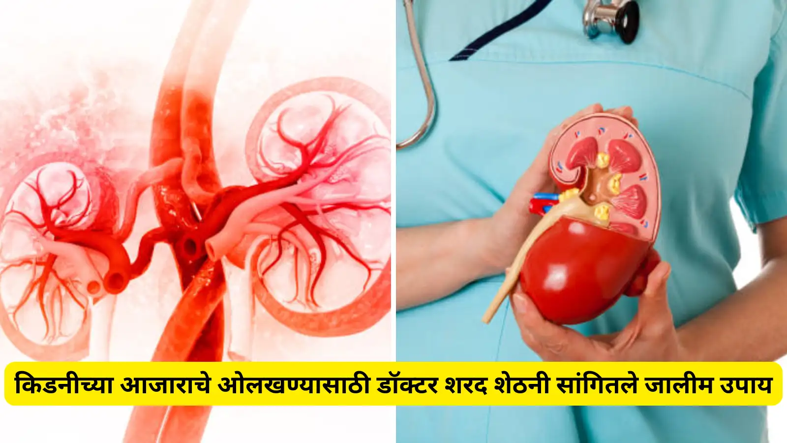 किडनीच्या आजाराचे ओळखण्यासाठी डॉक्टर शरद शेठनी सांगितले जालीम उपाय ...