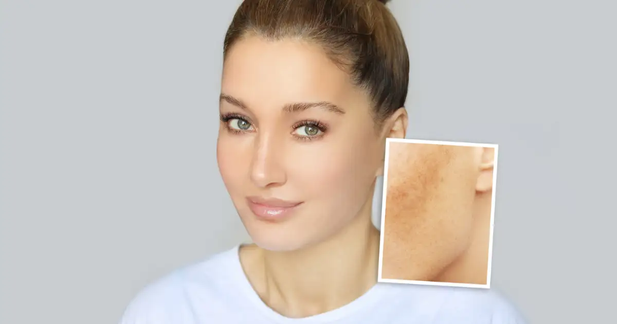 What Makes Indian Skin Tone Darker,गोरा करने वाली सारी क्रीम हैं बकवास ...