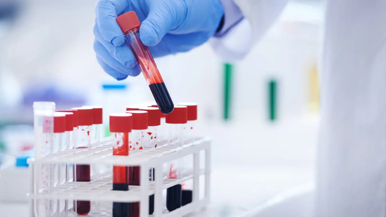 How to Prepare for a Fertility Blood Test: Tips and What to Expect