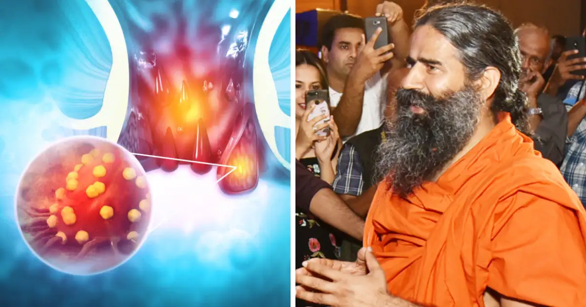 Baba Ramdev Home Remedies For Constipation Gets Immediate Effect ...