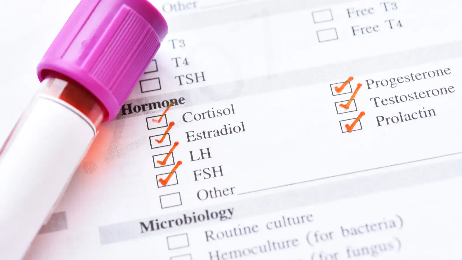 Week 1 Menstrual Cycle Hormone Levels: FSH, LH, Oestrogen