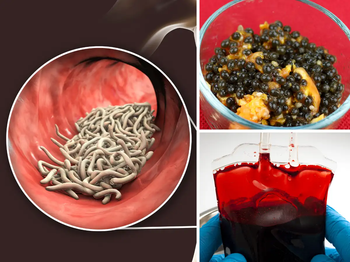 How To Naturally Kill Parasites In Your Body, ரத்தத்தை உறிஞ்சும் குடல் ...
