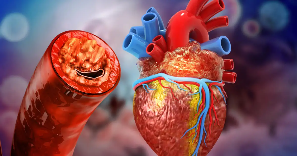 Heart Valvular and Blocked Heart Valve Disease Causes Symptoms and ...