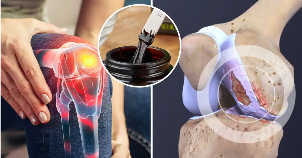 How To Increase Grease In Knees Home Remedies,10 दिन में खत्म होगी ...