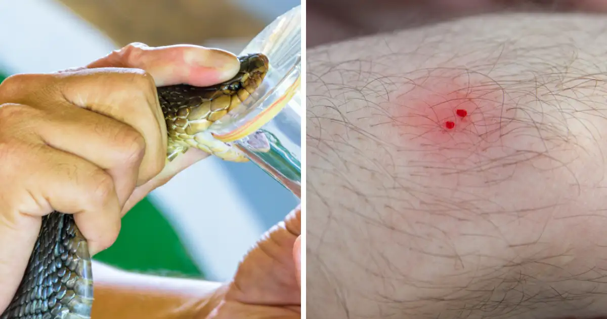 Snake Bite Treatment,Snake Bite: भारत में 50 लाख लोगों को काटते हैं ...