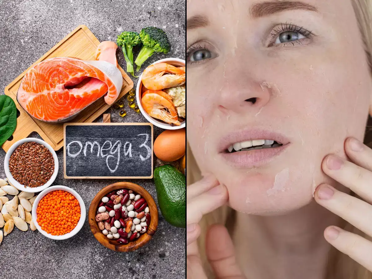 Top 5 Symptoms Of Omega-3 Deficiency : இந்த 5 மாற்றம் உடம்புல நடந்தா ...